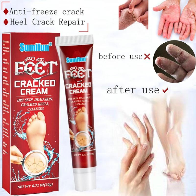 24H Delivery 】 Hand and foot chap cream exfoliating and repairing ...