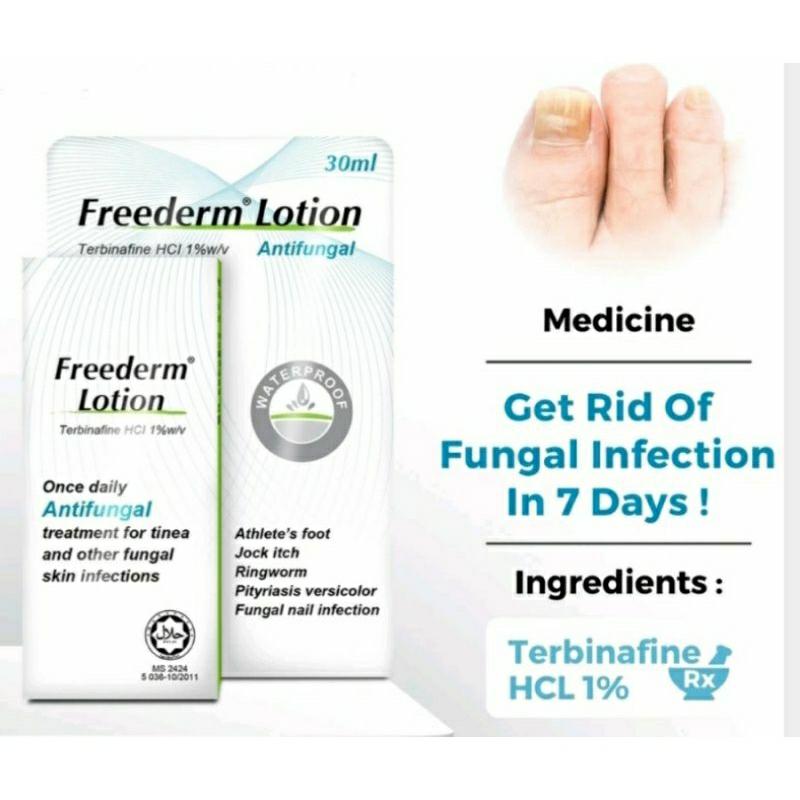 Freederm Lotion Antifungal 30ml untuk gatal / jangkitan kulat - TikTok ...