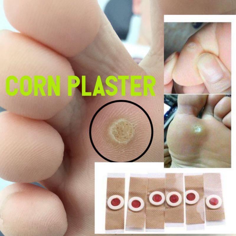 Plaster Penghilang Ketuat 6Pcs - Putih, Kulit - Menghilangka - TikTok ...