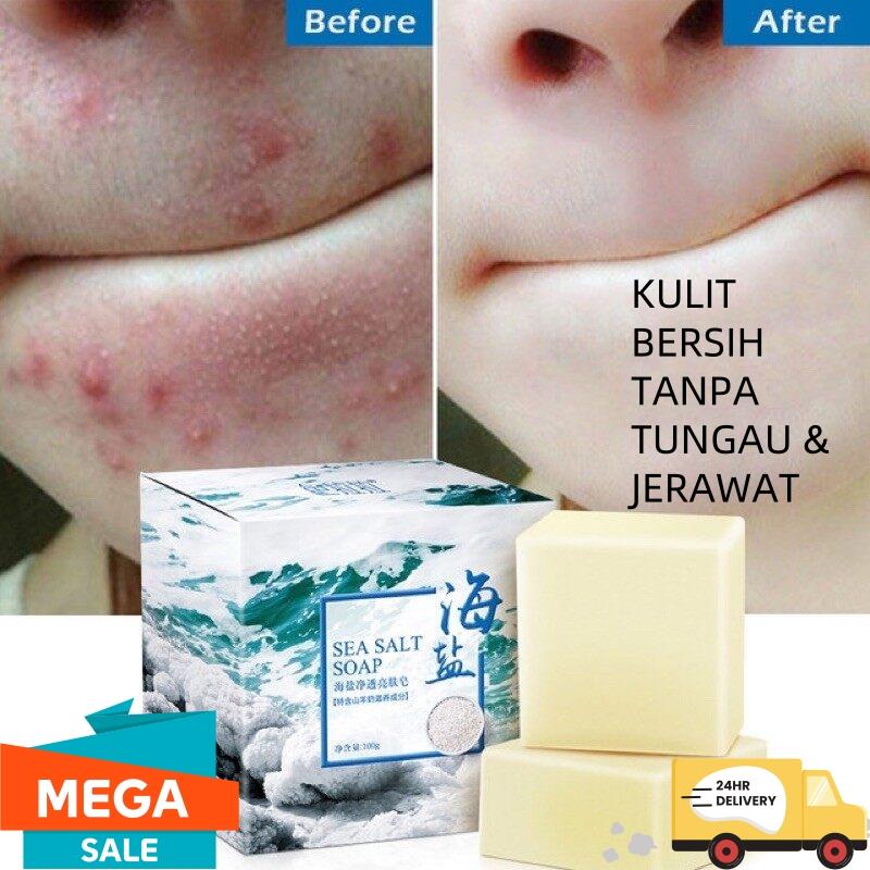 READY STOCK Sabun Garam Laut Asli Halal Basmi Tungau Jerawat - TikTok ...