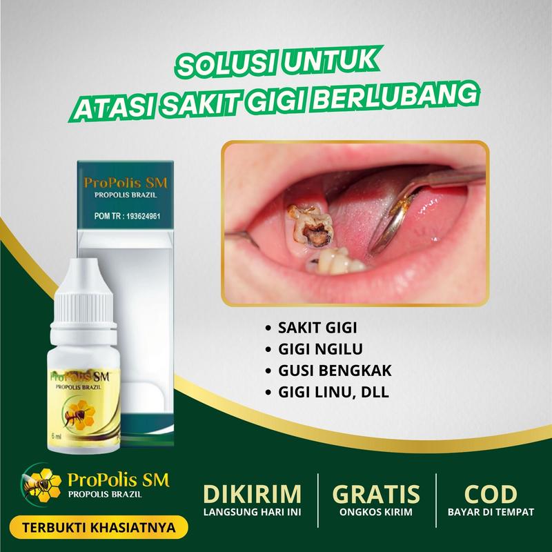 Sakit Gigi, Pereda Nyeri Sakit Gigi, Gusi Bengkak, Gigi Berlubang ...