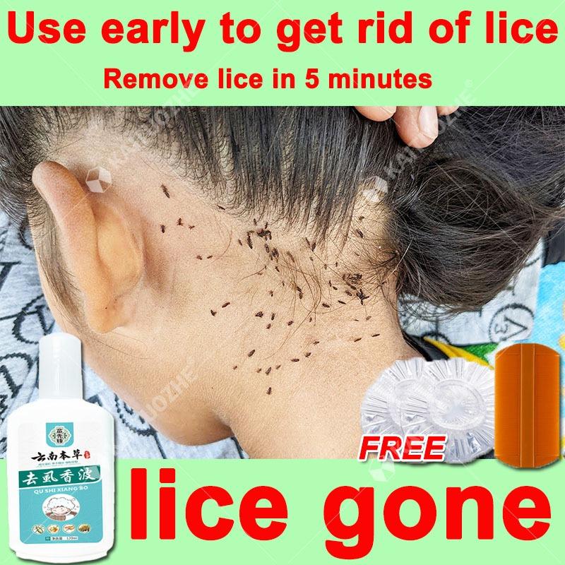 SkinMio【Lice Killer】Syampu Penyingkiran Kutu, 120ml, Syampu Penjagaan ...