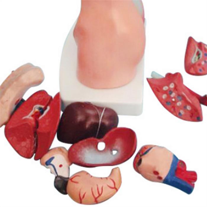 Jual Torso Mannequin Anatomy Doll 15 Removable Parts Educational Organ ...