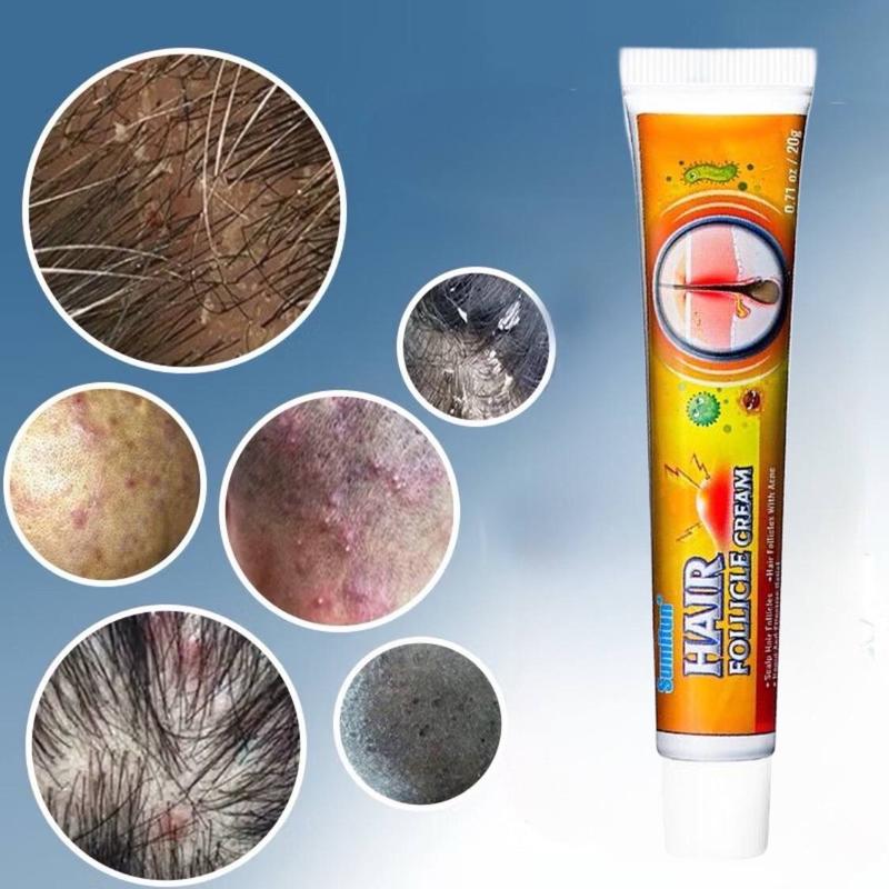 HAIR FOLLICLE CREAM krim folikel rambut kulit kepala bulu anti - TikTok ...
