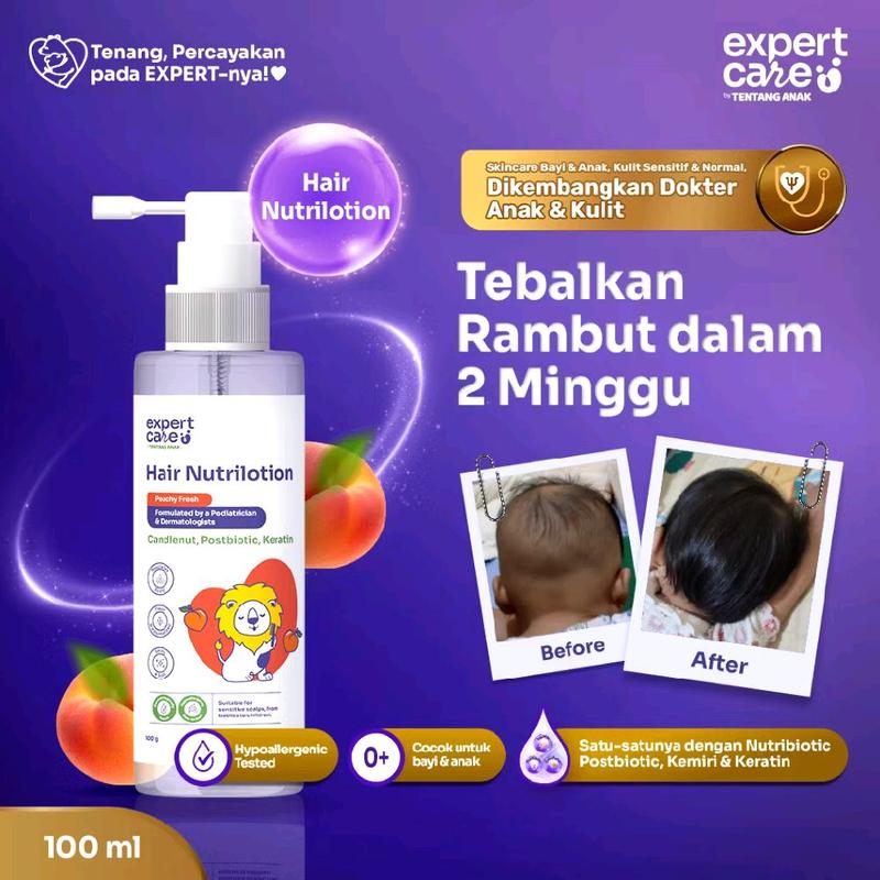 Expert Care Hair Nutrilotion 100 ml/Hair Lotion/Minyak Rambu - Shop ...