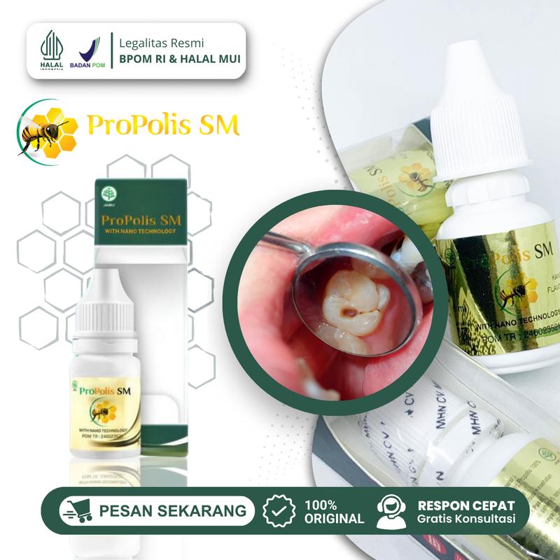 Propolis SM Obat Sakit Gigi Berlubang, Sakit Gigi dan Gusi Bengkak ...
