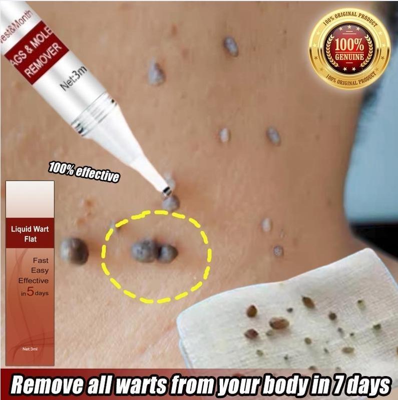 Tahi lalat remover Skin tag remover Buang tahi lalat dan kutil - TikTok ...