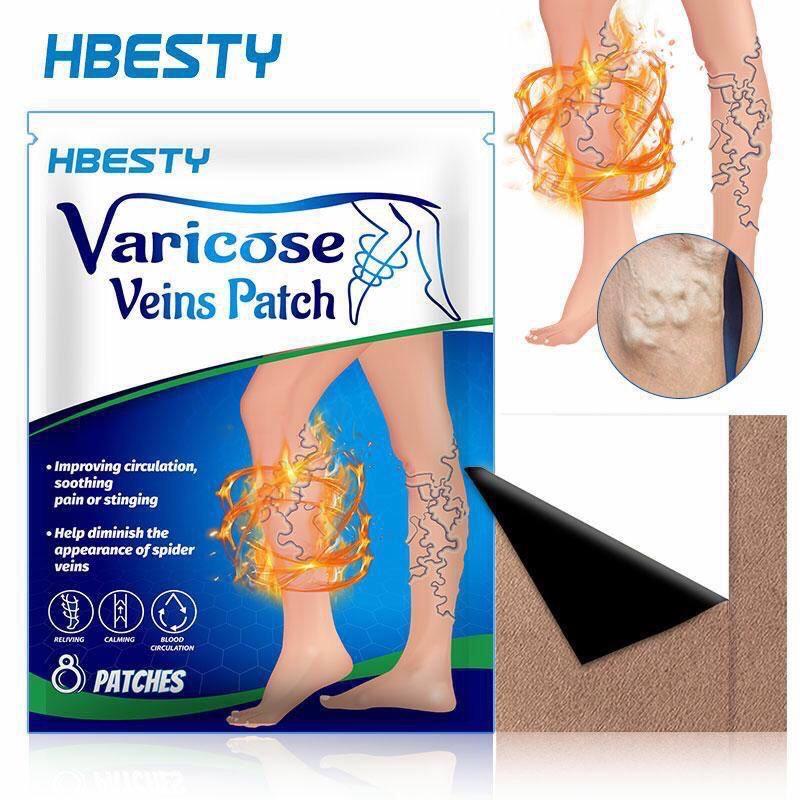 Hbesty varicose veins patch melegakan peredaran darah mengurangkan ...