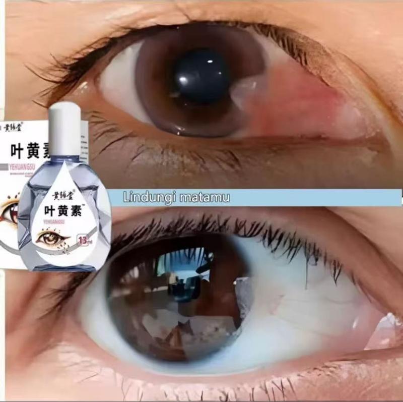 DAIGULA Tetes mata lutein blueberry untuk mata kering, lensa - Shop ...