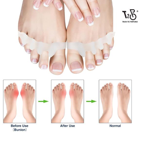T2P (One Pair) Silicone Toe Supporter Bunions Forefoot Sprea - TikTok ...