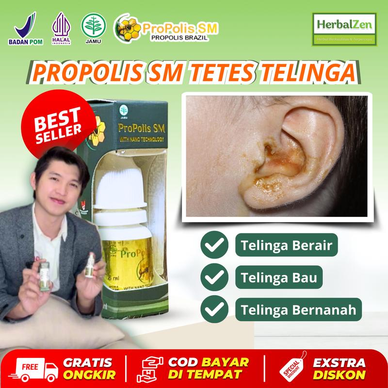 Propolis SM Obat Tetes Telinga Berair dan Bau Telinga Bernanah Ear ...
