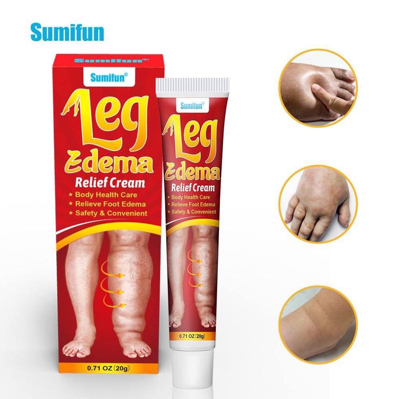 Krim Urutan Edema Anti Bengkak Leg Edema Cream 20g - Kulit, White ...