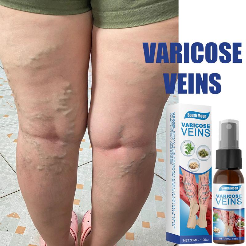 SPRAY VARICOSE VEINS Spray hilangkan urat bengkak urat angin - TikTok ...