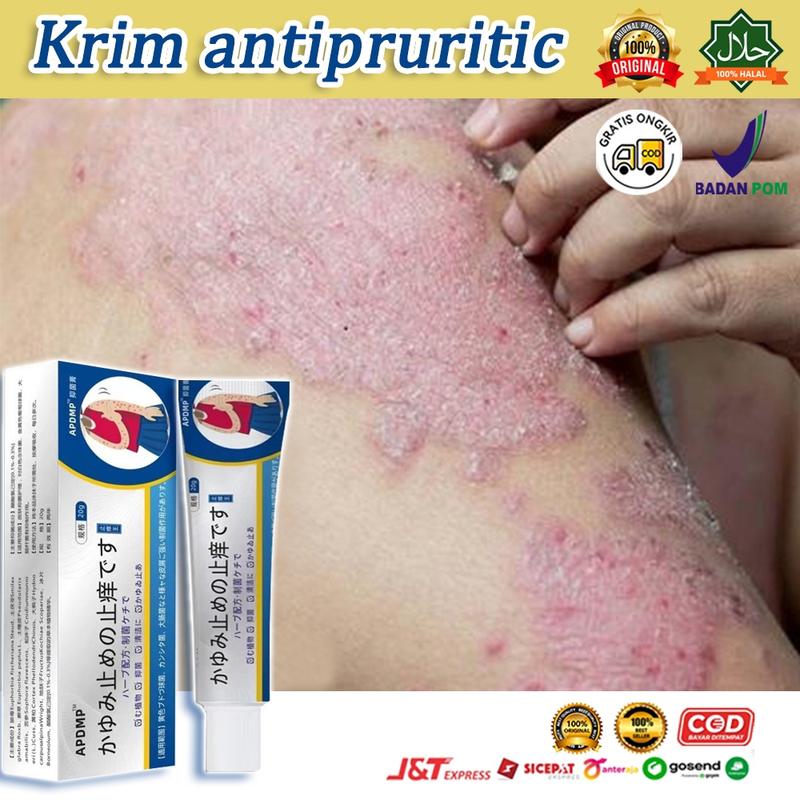 Salep Gatal Eczema Cream Psoriasis Cream Salep Kulit Jamur Dermatitis ...