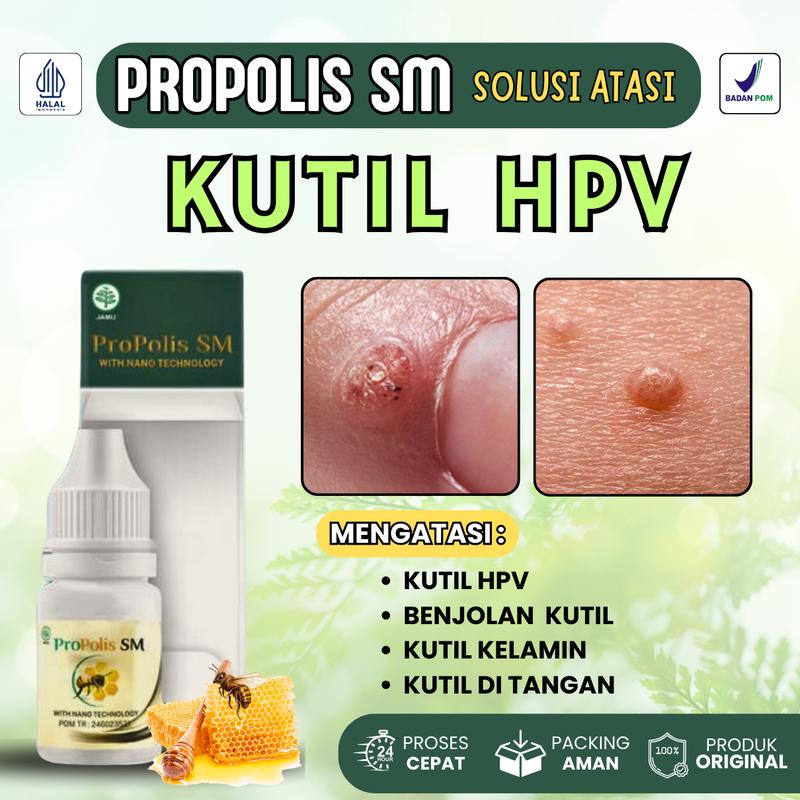 Propolis Sm - Atasi Kutil Hpv Perontok Kutil Kelamin, Daging Tumbuh ...