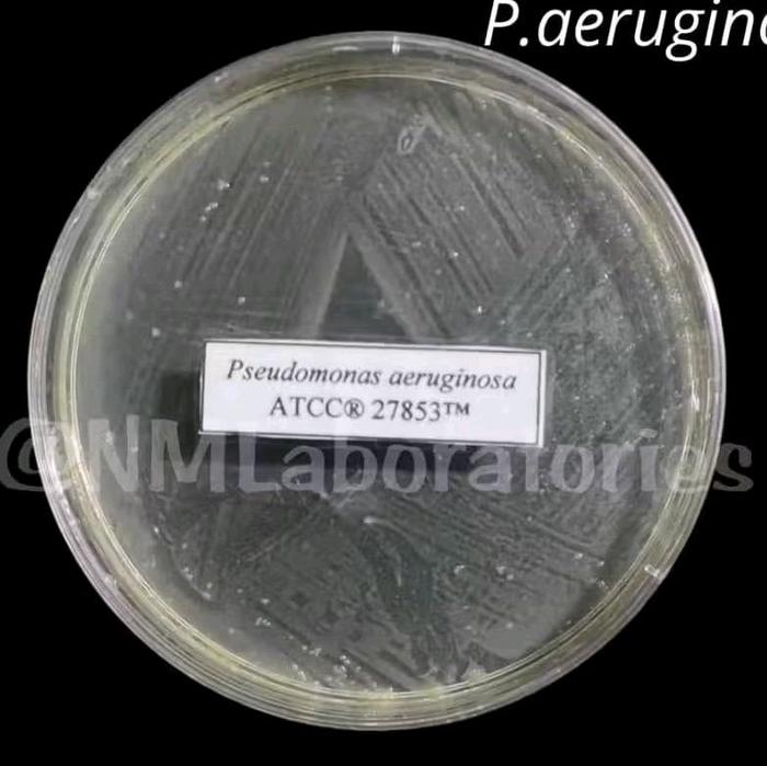 Jual Kultur Bakteri Pseudomonas aeruginosa ATCC 27853 – Siap Pakai ...