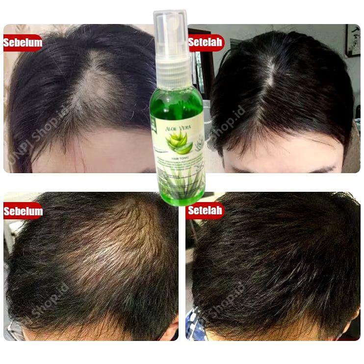 Terlaris Hair Story - Ginseng Dan Aloe Vera Hair Essence Oil Hair Tonic ...