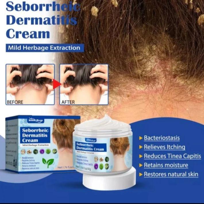 Seborrheic Dermatitis Cream 50g, Krim Kulit Gatal Non-iritasi 50gr ...