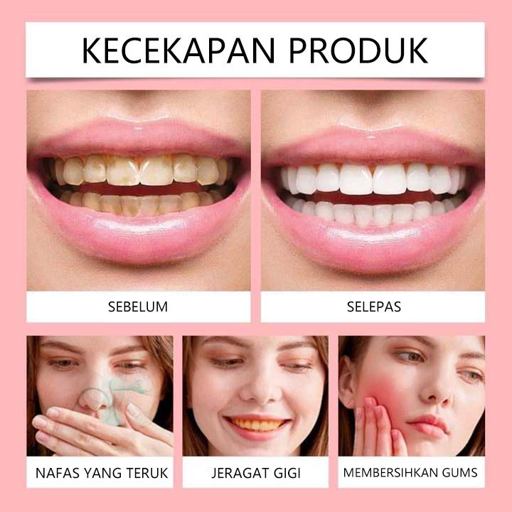 Pasta Gigi Pemutih SP - 6, Pasta Gigi Probiotik Penghalang Pereputan ...