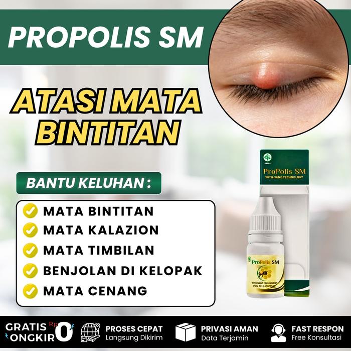 Jual Propolis Sm Oles Mata Bintitan, Mata kalazion, benjolan Di Kelopak ...