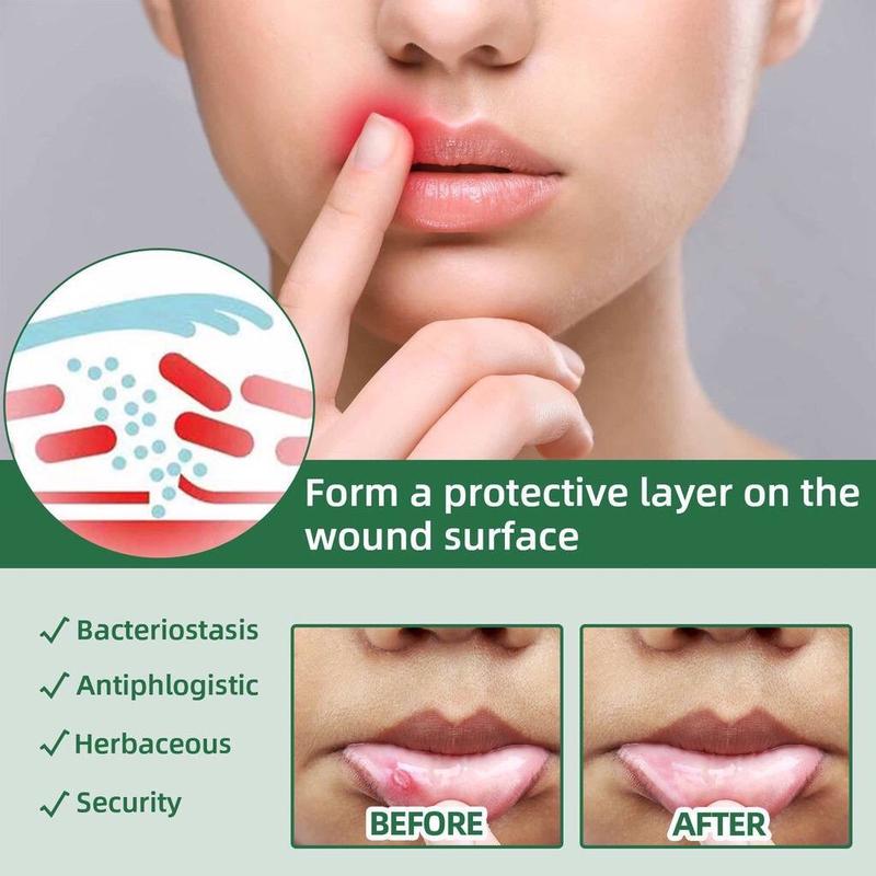 Yaojian Barry Mouth Ulcer Spray Spray anti-ulser mulut Melindungi ...