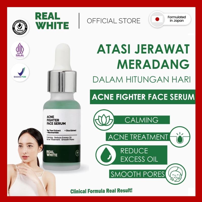 REAL WHITE Acne Fighter Face Serum - Shop | Tokopedia