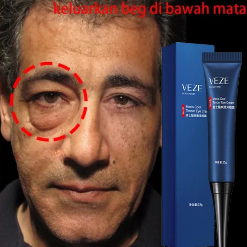 Eye Cream Krim Mata Fat granule remover Dark circle removal - TikTok ...