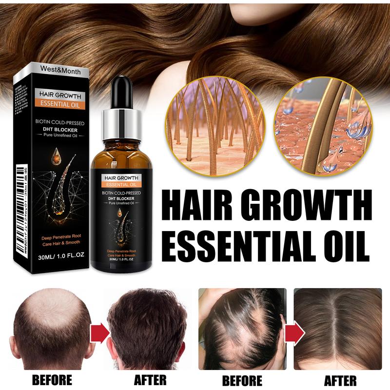 Minyak Rawatan Rambut West&Month - Promosi Pertumbuhan Rambu - TikTok ...