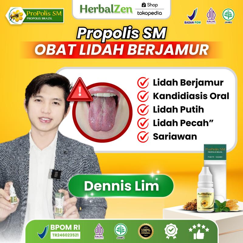 Propolis SM Obat Lidah Berjamur Sariawan Di Lidah Jamur Lidah Dewasa ...
