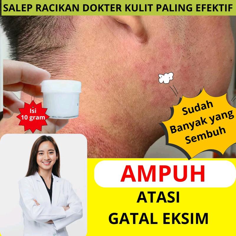 Salep Krim Racikan Dokter Kulit Untuk Atasi Gatal Eksim Scabies - Shop ...