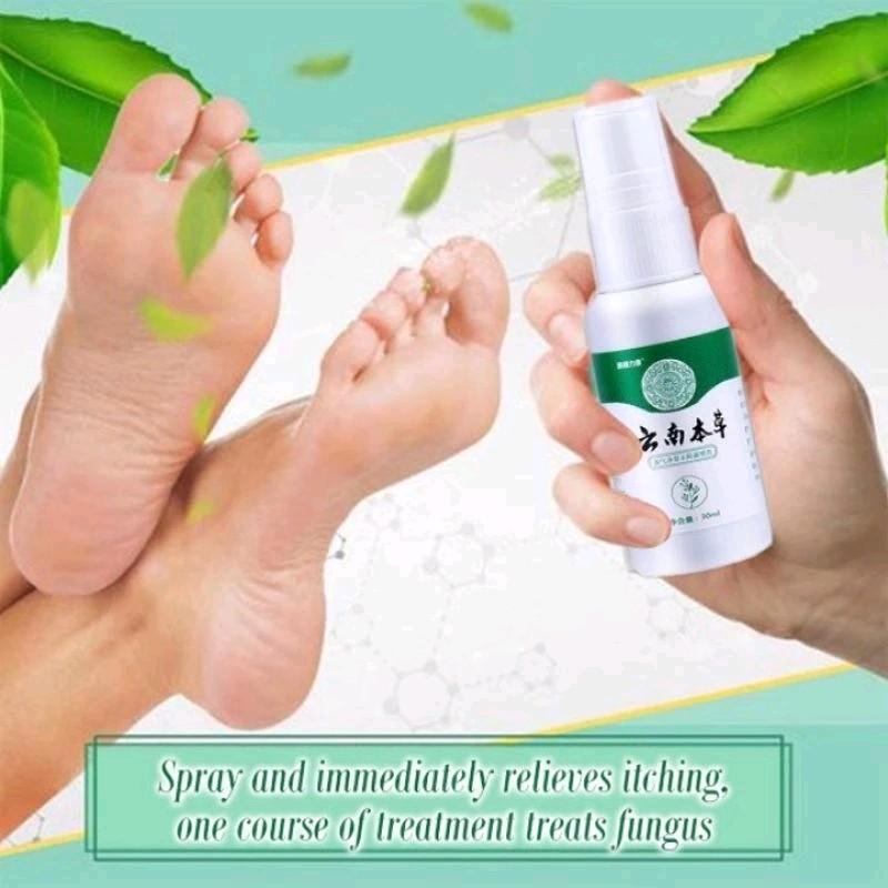 Athlete's Foot Treatment Spray Cures Most Foot Between Toes Rapid ...