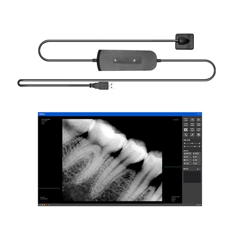 Dentistry Digital Cameras Sensor X-Ray High-Frequency Rx Digital - Shop ...