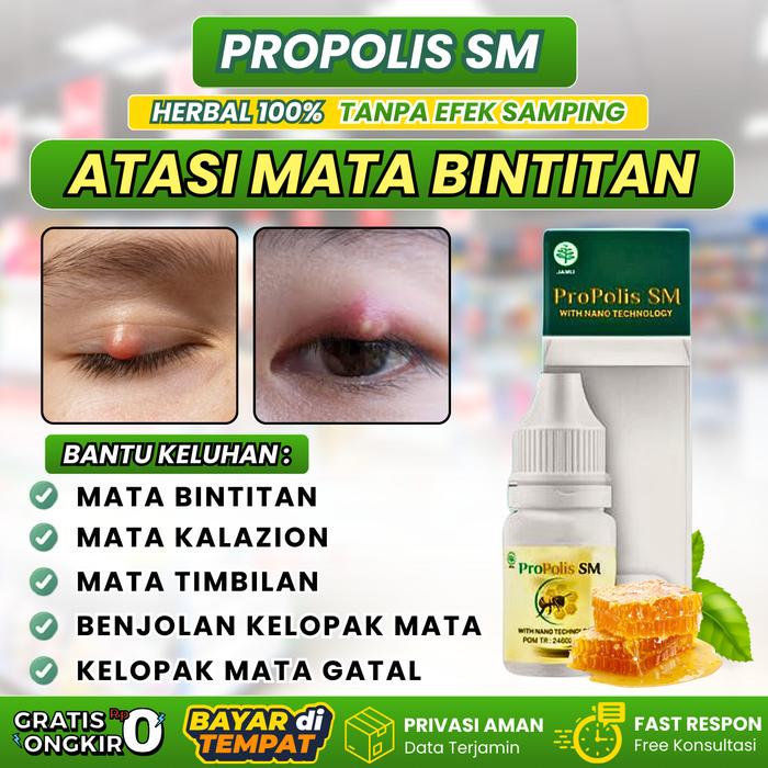 Jual Propolis Sm Herbal Oles Mata Bintitan Isi 6ml Original - Jakarta ...