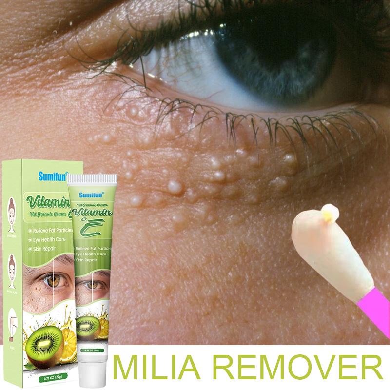 Eye Cream Krim Milia Seed Remover Eye Care Fat Granule Syringoma ...
