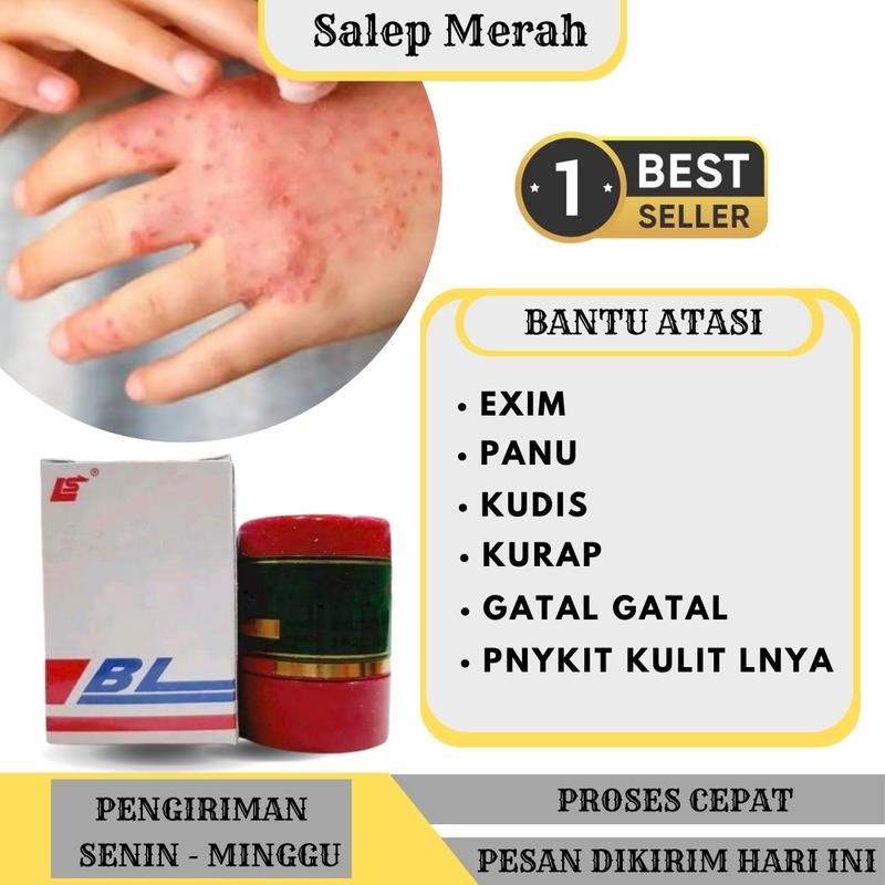 Salep Kutu Air Sela Jari Kaki Tangan Salep Bl Original 100 Asli - Shop ...