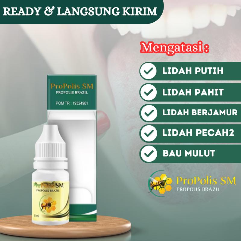 ProPolis SM tetes Kumur Lidah Putih, Lidah Berjamur, Lidah Luka - Shop ...
