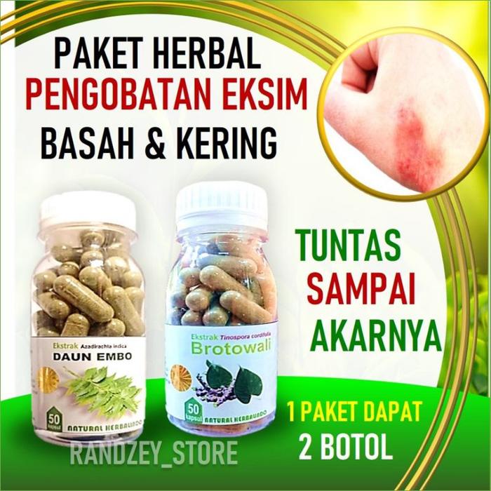 Jual OBAT EKSIM KERING EXIM BASAH PENYAKIT KULIT GATAL PARAH ALERGI ...