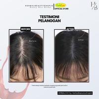 Promo Herbalove Shampoo Kemiri Penumbuh Rambut Merang 250ML Herbalove ...