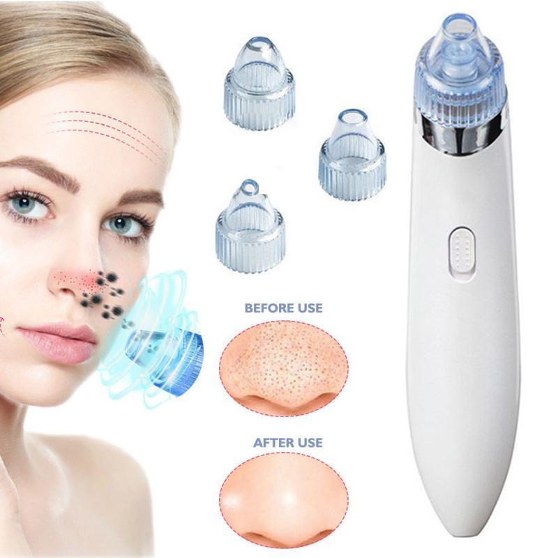 Mizze Blackhead Vacuum Lite Cleaning Instrument Device Acne Removal ...