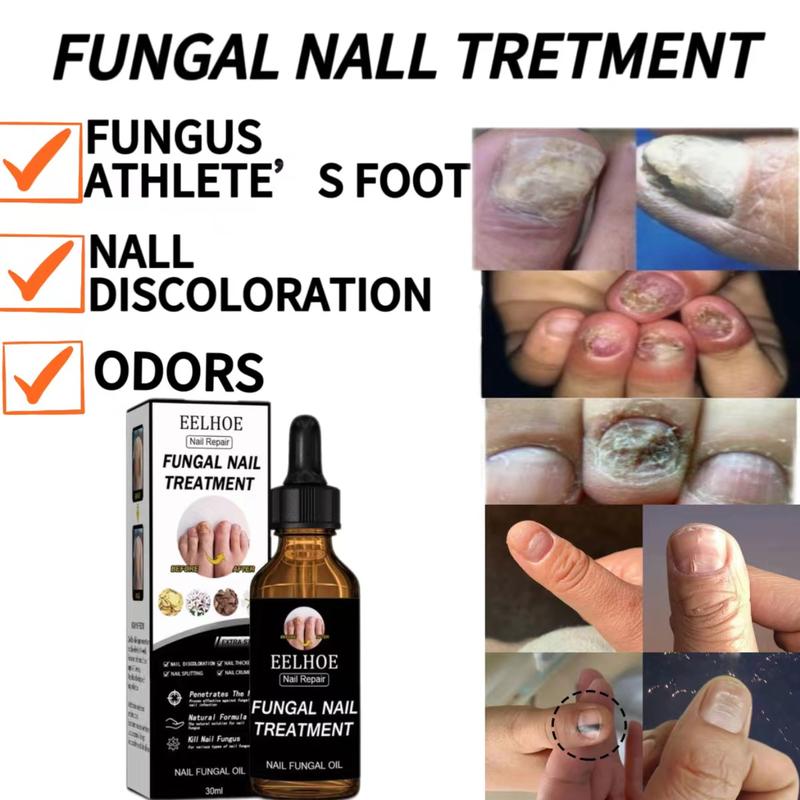 Shine Nail Nutrient Solution Thickening Remove Gray Nails Dead - TikTok ...