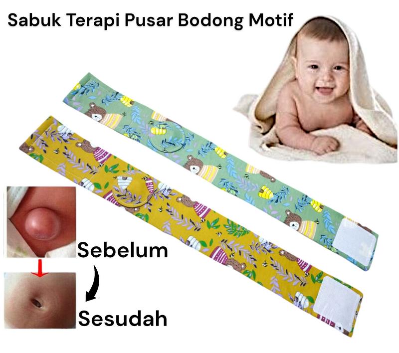 Sabuk Hernia Bayi Motif Empuk untuk Terapi Pusar Bodong pada Bayi ...