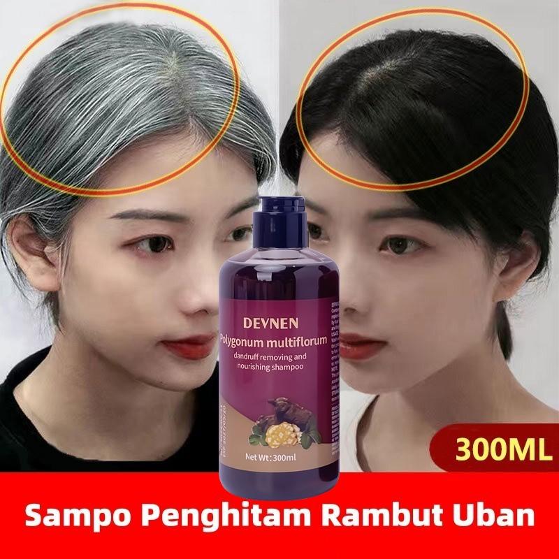 Shampo Penghilang 300ml Uban Penghitam Black Herbal Natural Polygonum ...