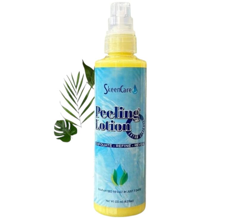 CFS SkeenCare Peeling Lotion - 100ml, Renews Skin and Remove - TikTok ...