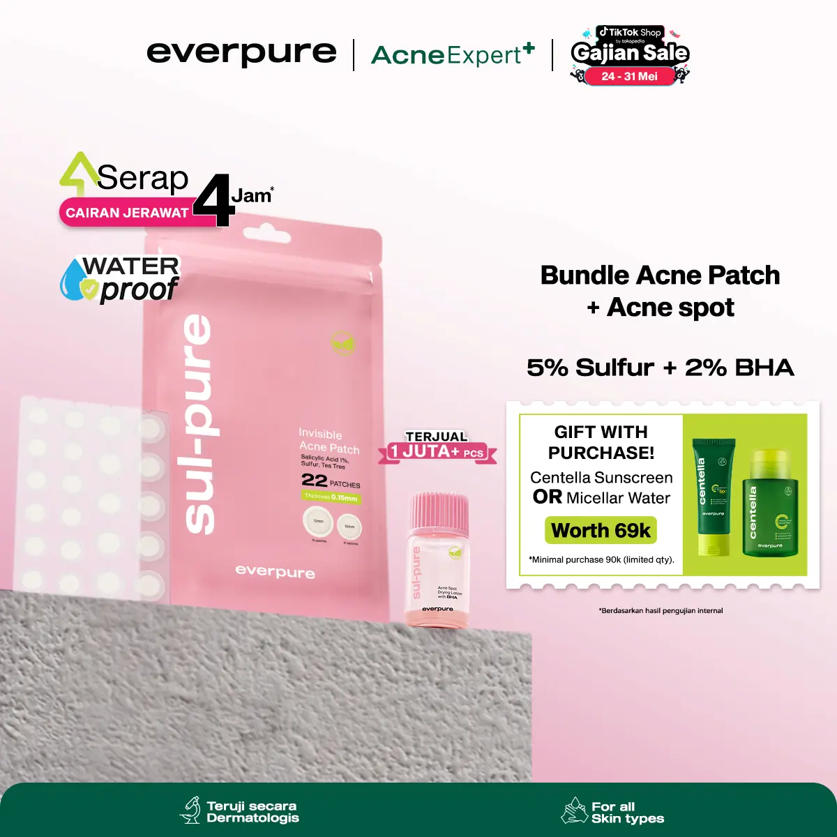 [Exclusive Tiktok] EVERPURE Acne Rescue Kit Bundle | Sulpure Invisible ...