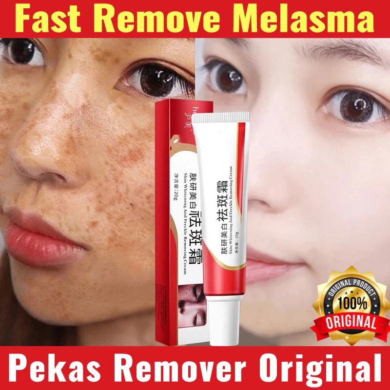 Effective Melasma Cream for Pekas Freckles Dark Spots with Collagen ...