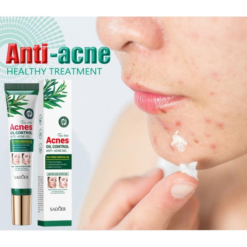 Acne gel Ubat jerawat dan parut Pimple cream Shrinking Pores - TikTok ...