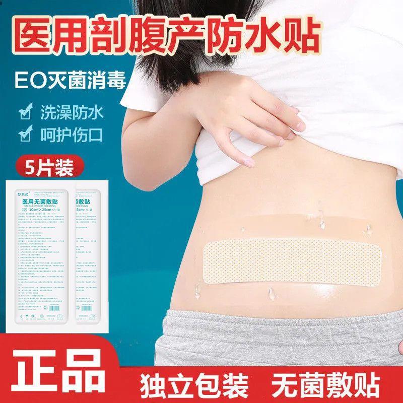 Cesarean Section Medical Wound Waterproof Paste Sterile Application ...