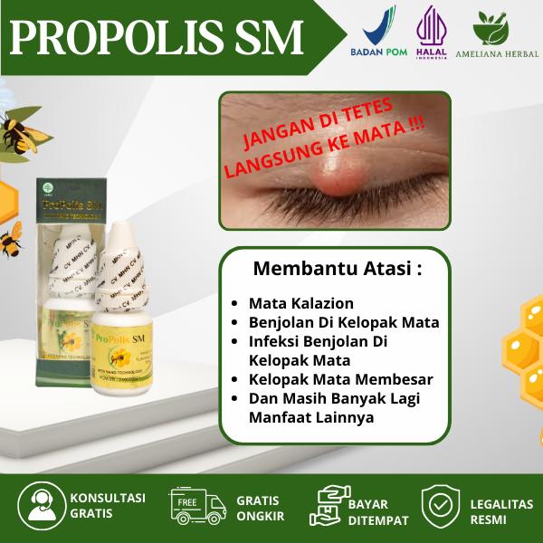 Propolis SM - Untuk Mata Kalazion Benjolan Di Kelopak Mata Infeksi ...