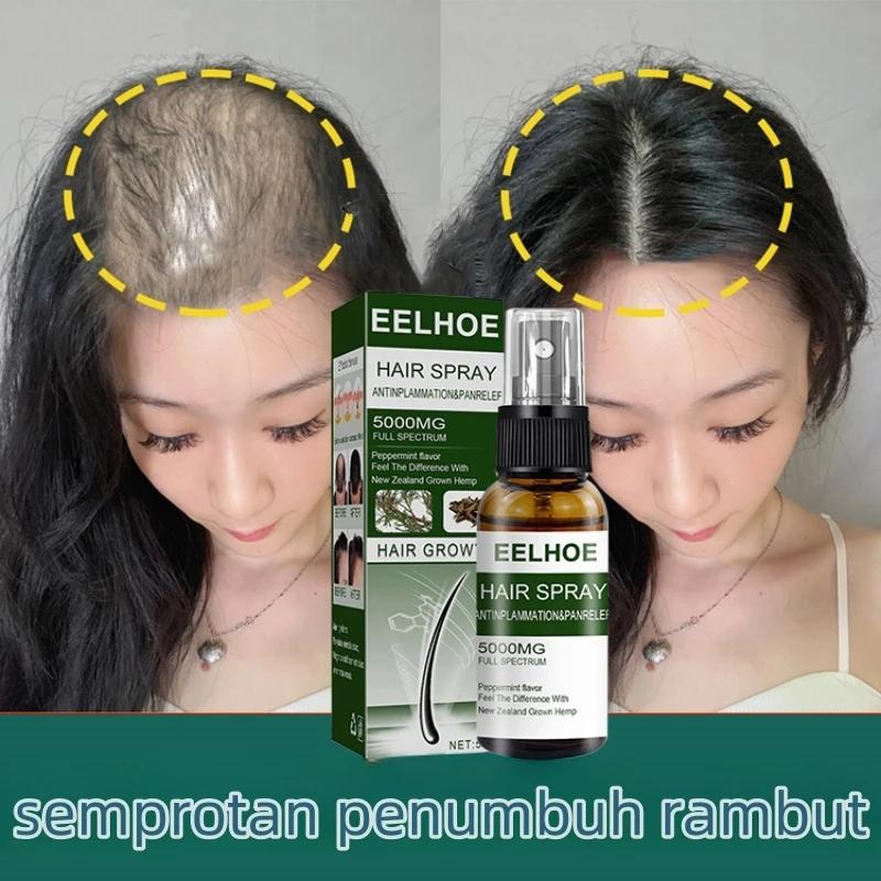 Penumbuh Rambut Botak Semprotan Penumbuh Rambut Obat Rambut Botak Serum ...