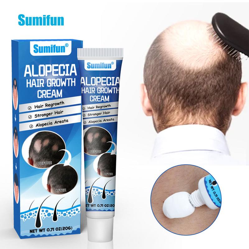Baldness Cream 20g Anti Alopecia Fast Hair Growth Oil Anti Alopecia ...